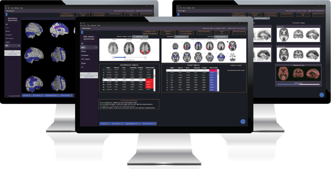 Neurology Solutions from Catalyst MedTech